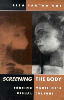Screening the Body: Tracing Medicine's Visual Culture a book by Lisa ...