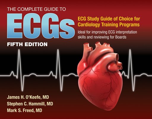 The Complete Guide to Ecgs: A Comprehensive Study Guide to Improve ECG ...