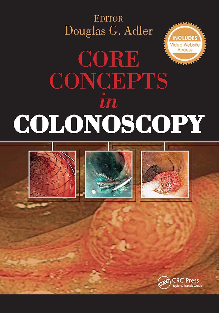 Core Concepts in Colonoscopy a book by Douglas Adler MD - Bookshop.org US