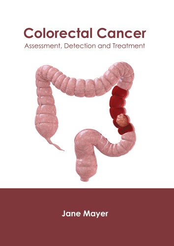 Colorectal Cancer: Assessment, Detection and Treatment a book by Jane Mayer