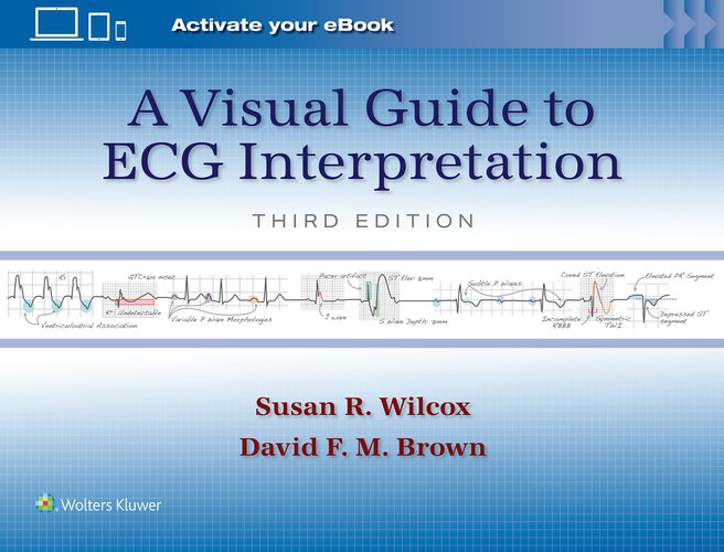 A Visual Guide to ECG Interpretation: Print + eBook with Multimedia a ...