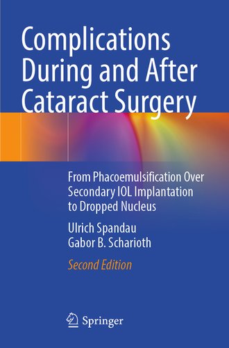 Complications During and After Cataract Surgery: From ...
