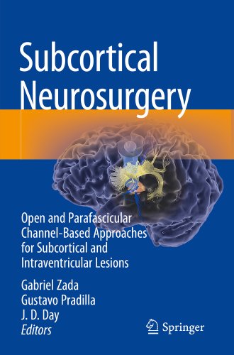 Subcortical Neurosurgery: Open and Parafascicular Channel-Based ...