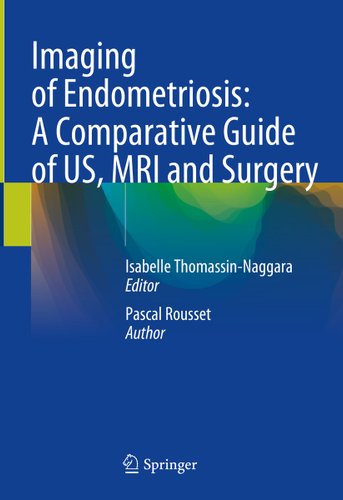 Imaging of Endometriosis: A Comparative Guide of Us, MRI and Surgery a ...