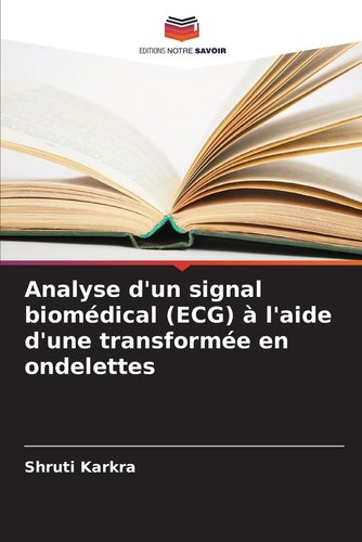 Analyse d'un signal biomédical (ECG) à l'aide d'une transformée en ...