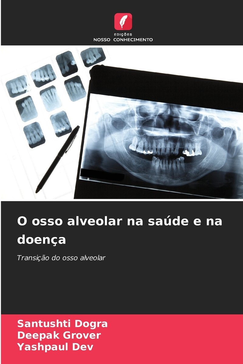 O osso alveolar na saúde e na doença a book by Santushti Dogra, Deepak ...
