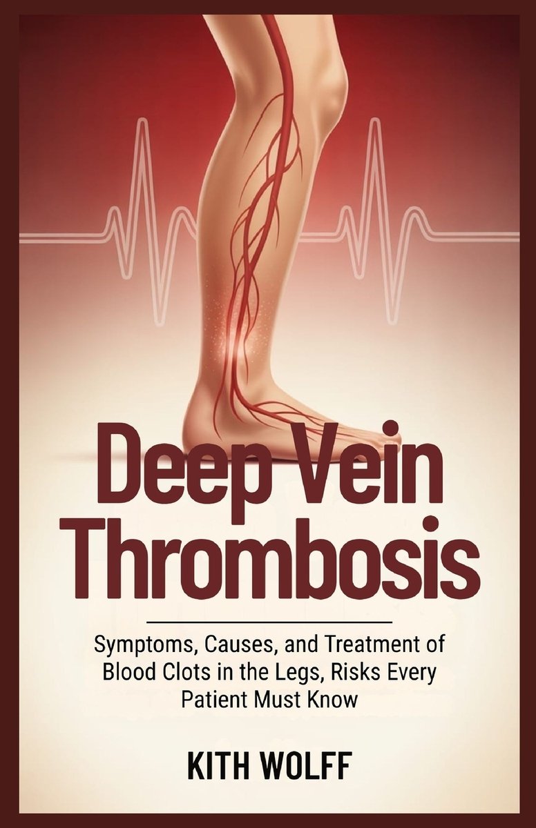 Deep Vein Thrombosis a book by Kith Wolff - Bookshop.org US