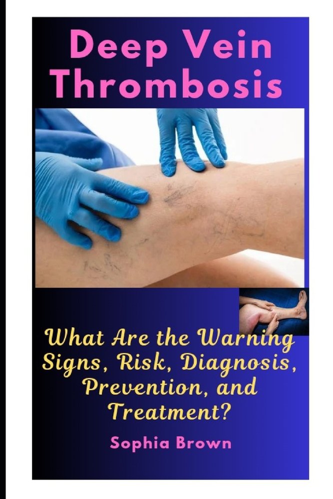Deep Vein Thrombosis a book by Sophia Brown - Bookshop.org US